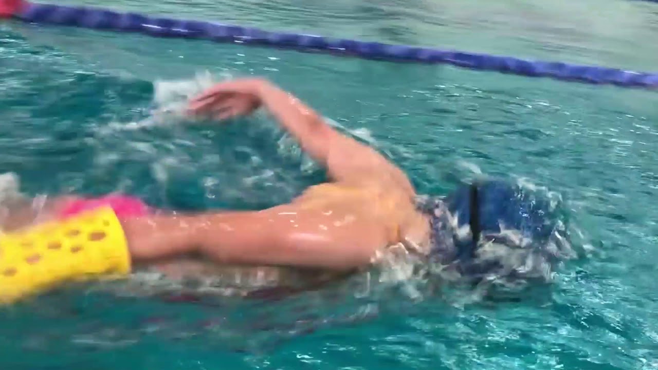 ActivArmor 3D Printed Casts Supports Active Lifestyles - YouTube