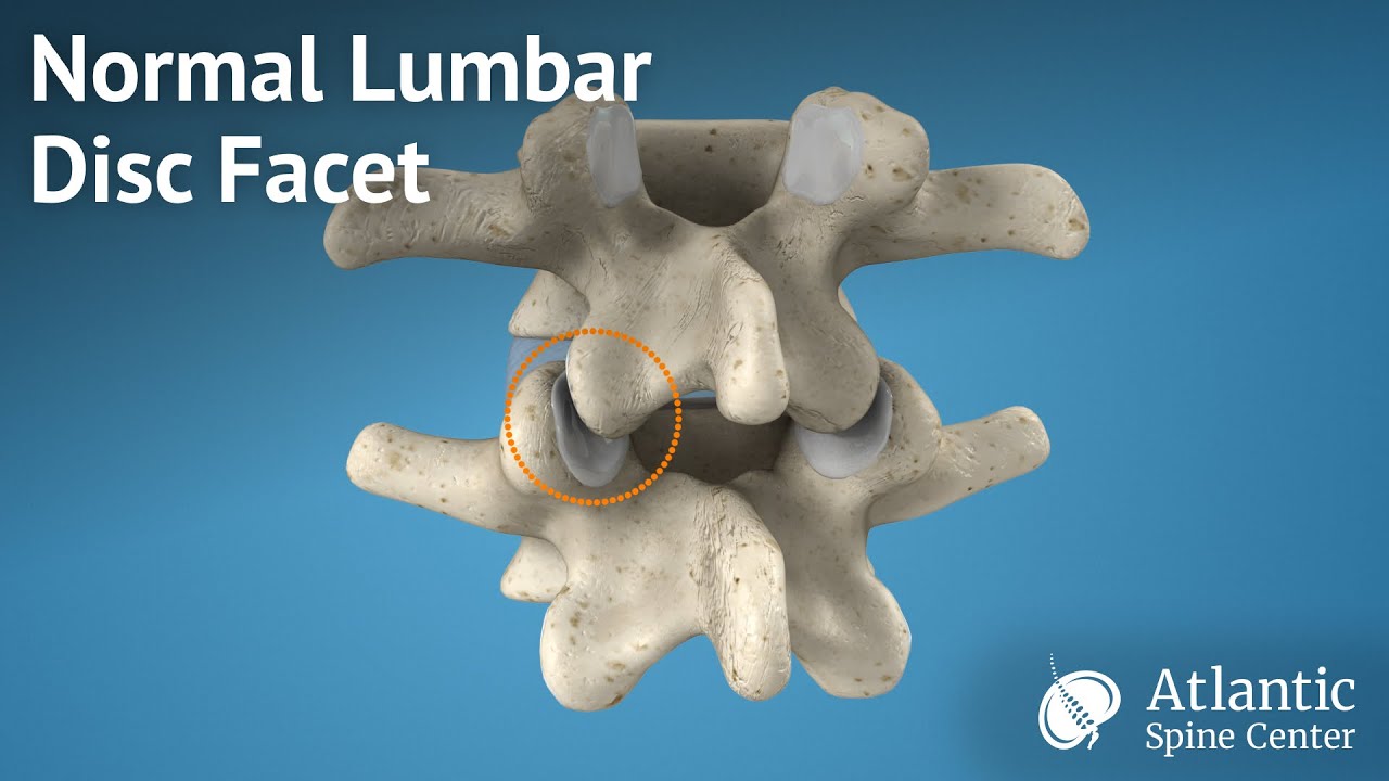Lumbar Vertebrae Facet Anatomy