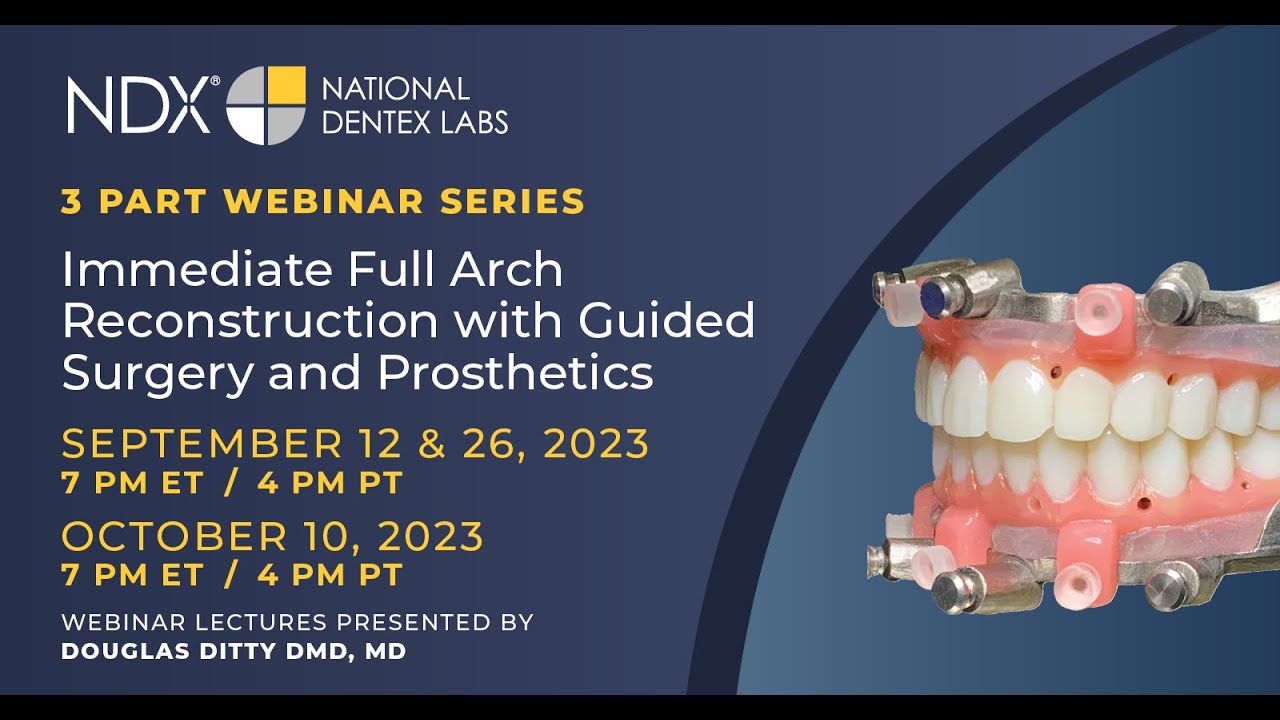 Immediate Full Arch Reconstruction with Guided Surgery and Prosthetics ...