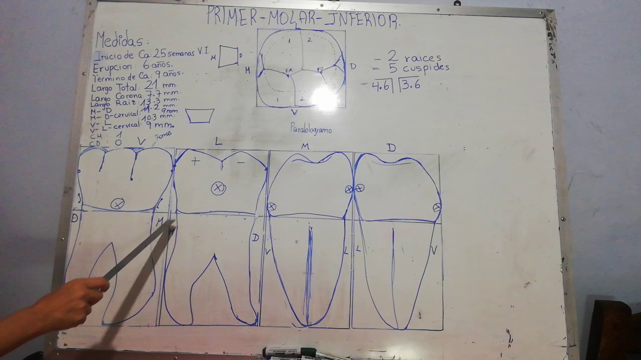 Descripción Anatómica del Primer Molar Inferior - YouTube