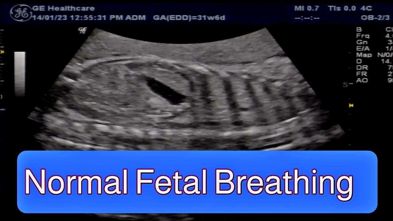 What Is Normal Baby Breathing at Kate Gates blog