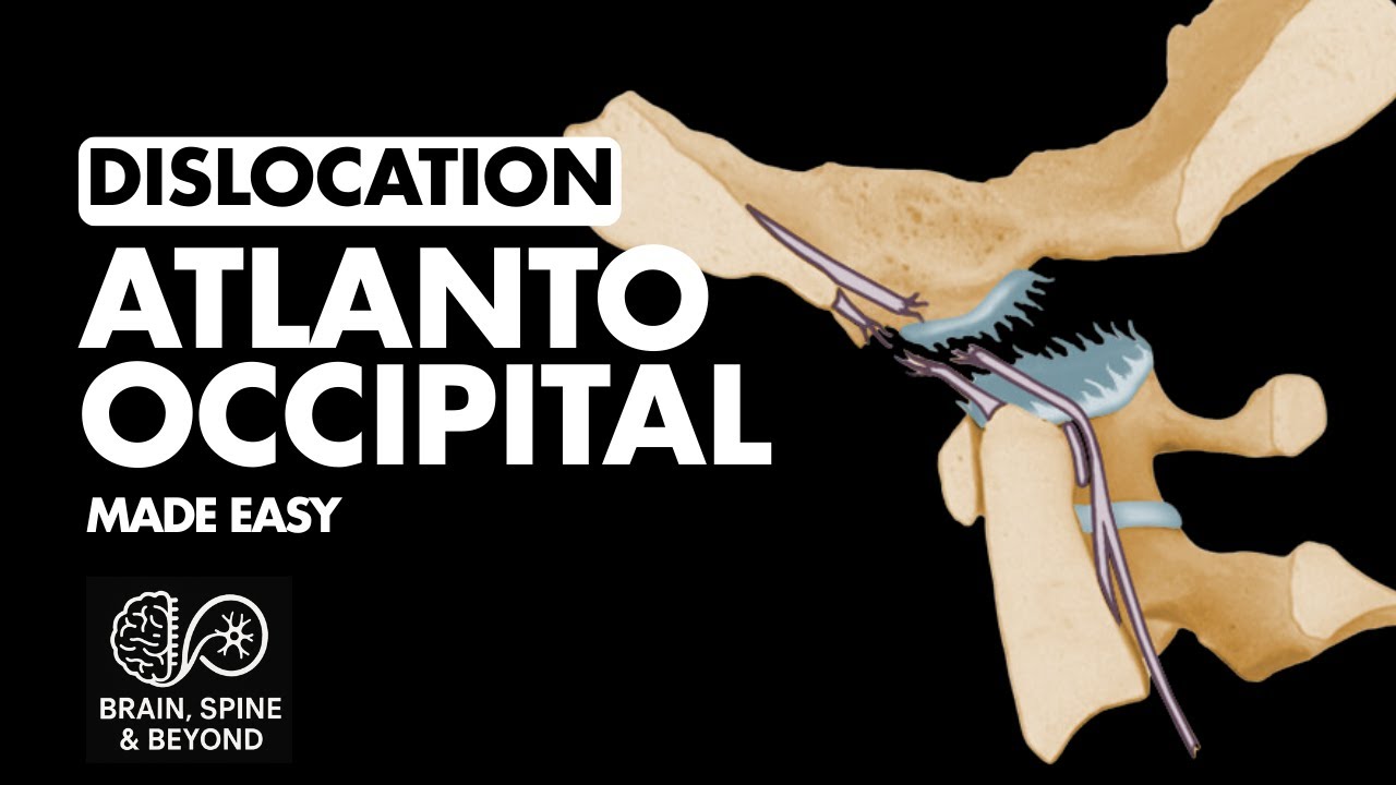 Atlanto Occipital Dislocation