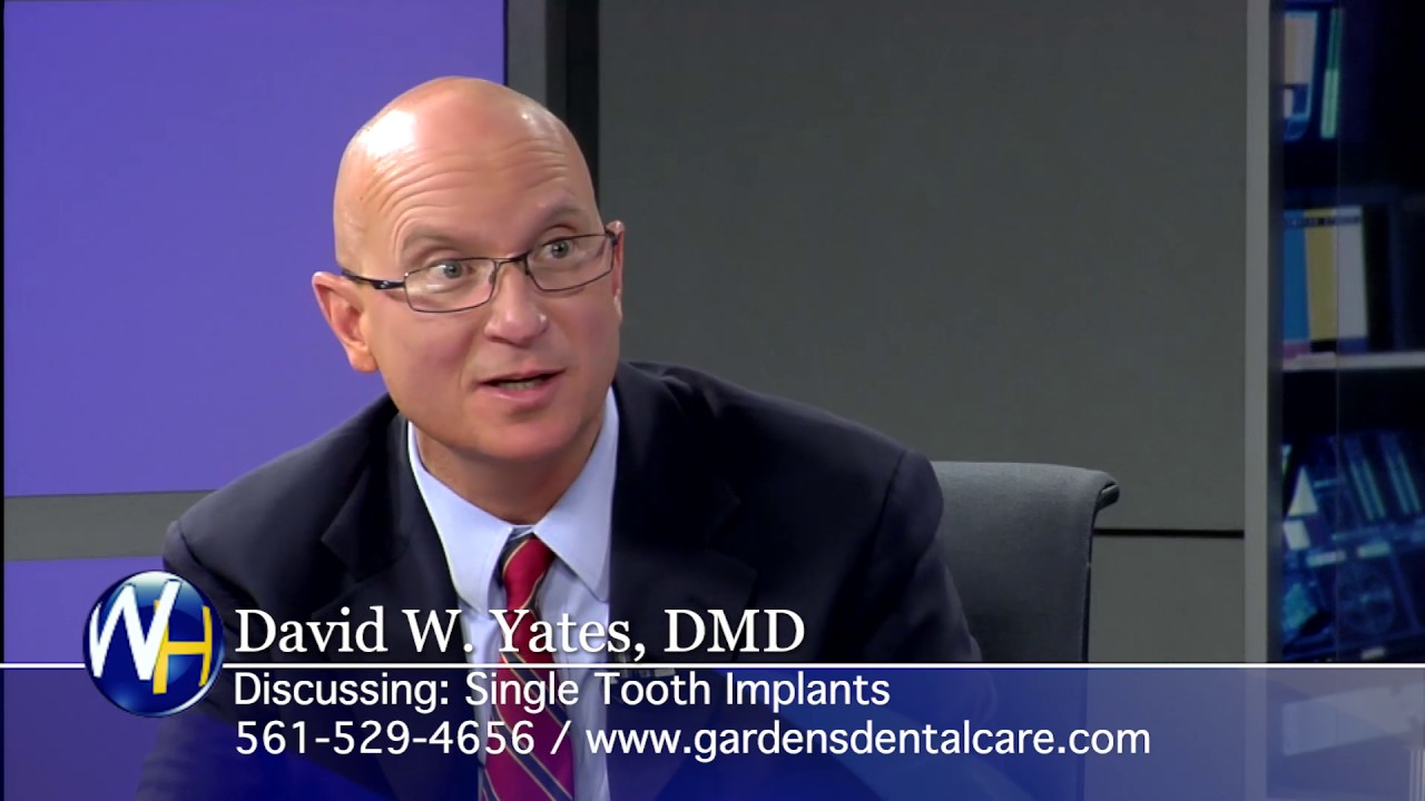 Single Tooth Implants with Palm Beach Gardens, FL dentist, David Yates ...