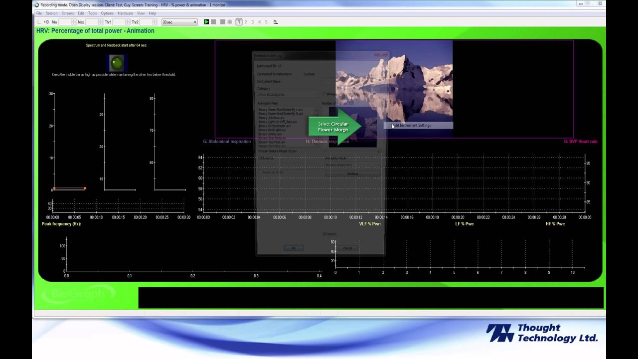 BioGraph Infiniti Software Tutorial - Chapter 2.4 Editing Screens on ...