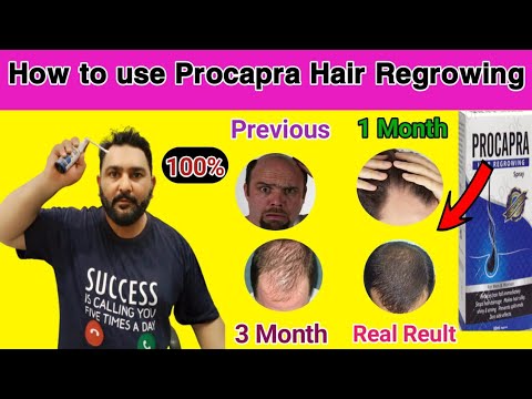 How to use Procapra Hair Growing Spray | Treatment of hair lose ...