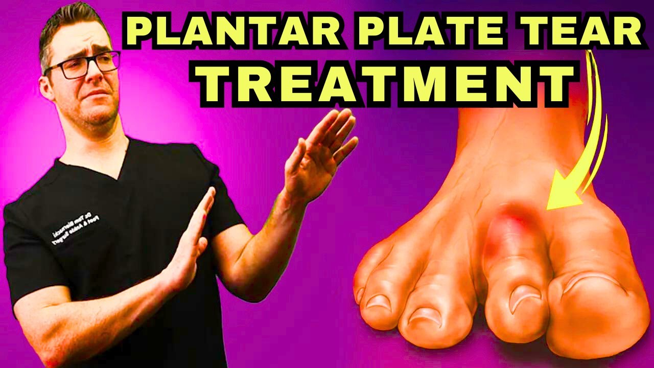 Second Toe PAIN & Plantar Plate Tear INJURY [Taping & BEST Treatment ...