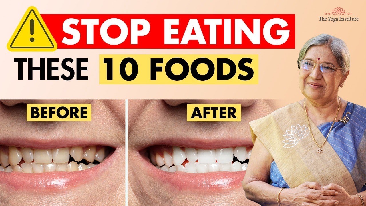 10 worst foods for teeth | Oral/dental health tips | Naturally detoxify ...