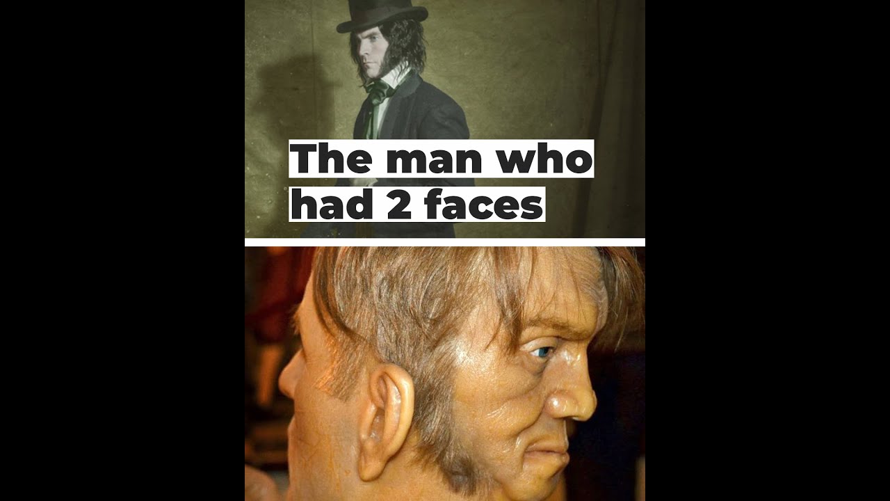 The man who had 2 faces - YouTube