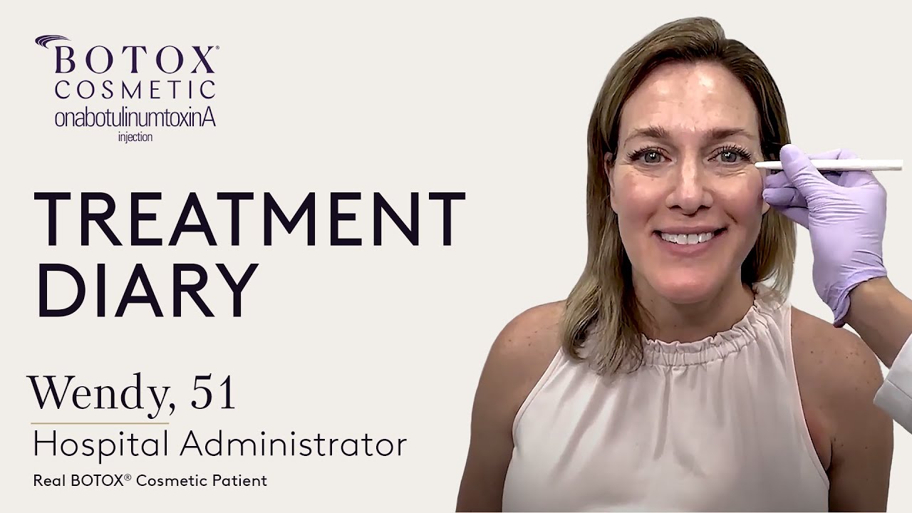Wendy, 51 — BOTOX® Cosmetic Treatment Diary - YouTube