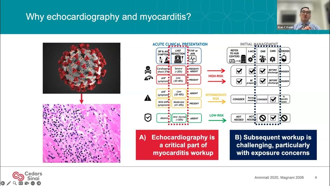 Deep Learning of Echocardiography for Detection of Myocarditis ...