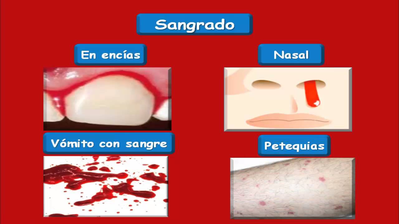 DENGUE: Síntomas y prevención del Dengue - YouTube