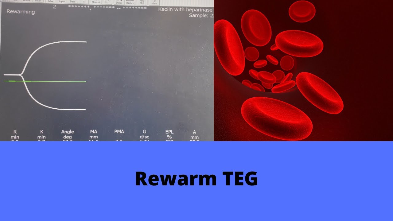 Rewarm TEG - YouTube