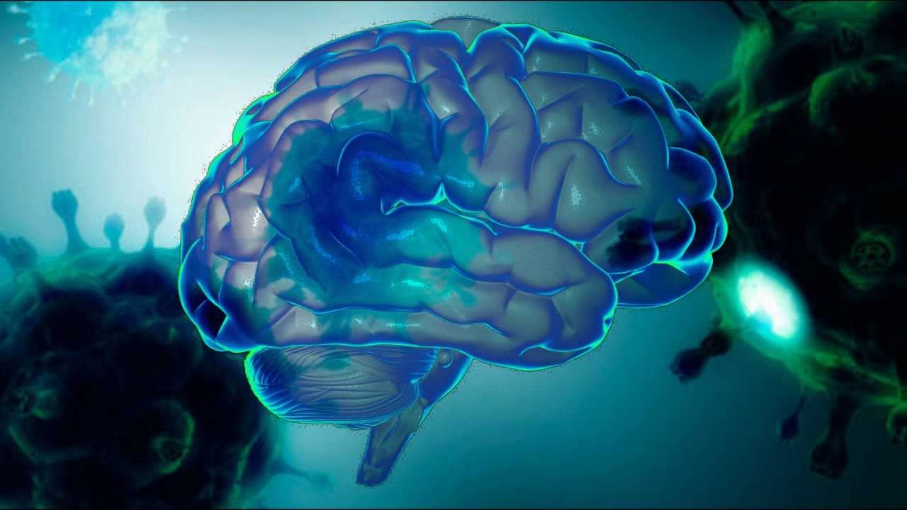 "Necrosis" - YouTube