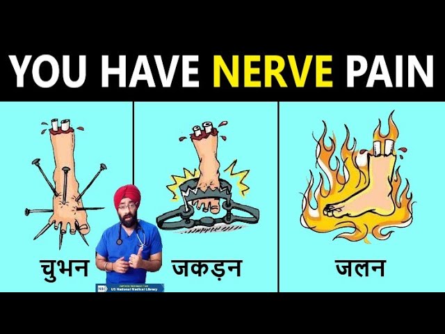Nerve Pain Memes