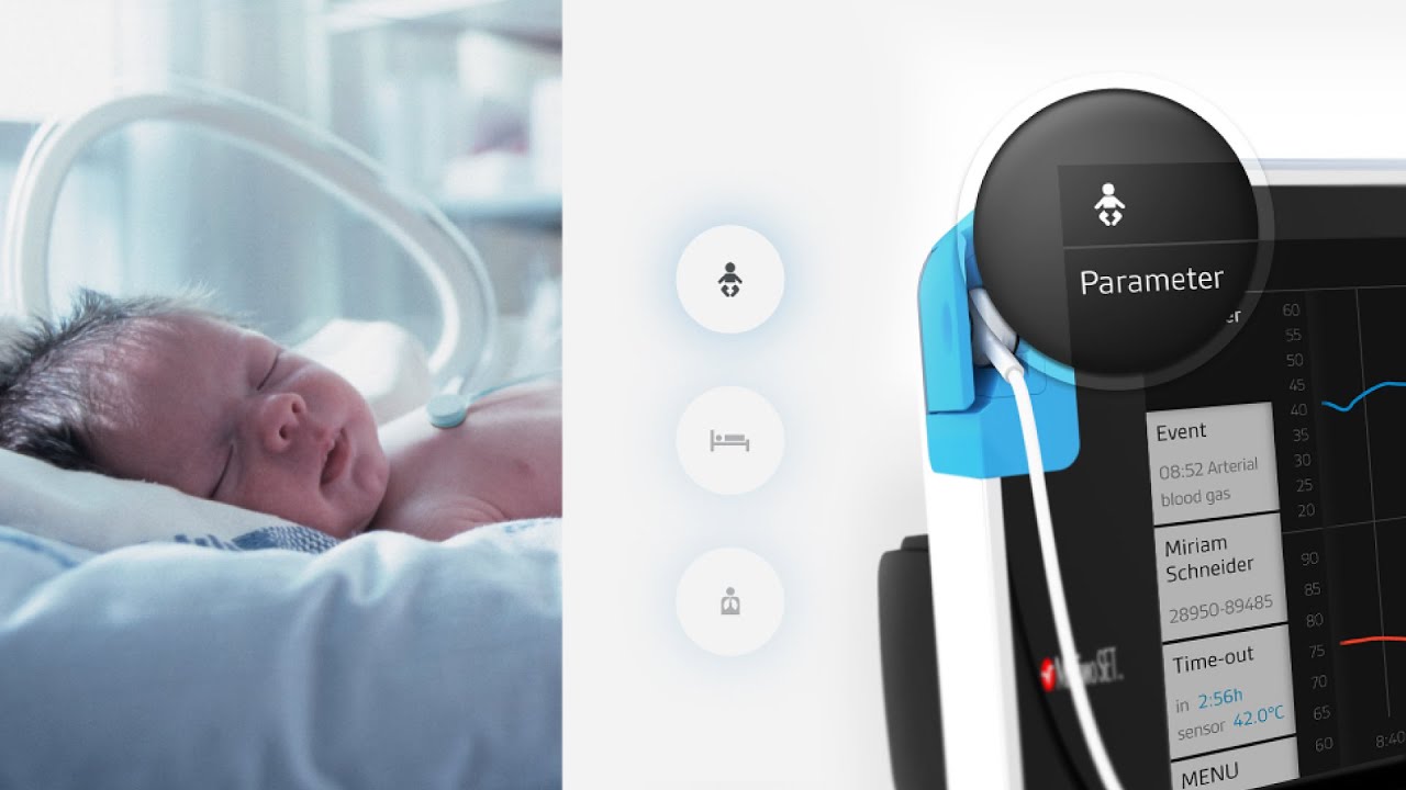 Radiometer - TCM5, Smart blood gas monitoring - YouTube