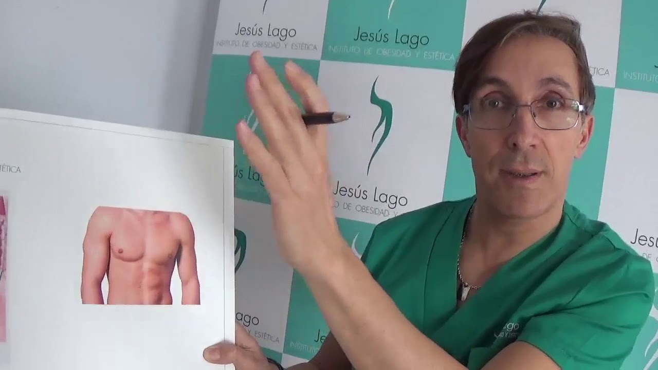 Dr Jesus Lago - Mamoplastia con Injerto Libre de Areola - YouTube