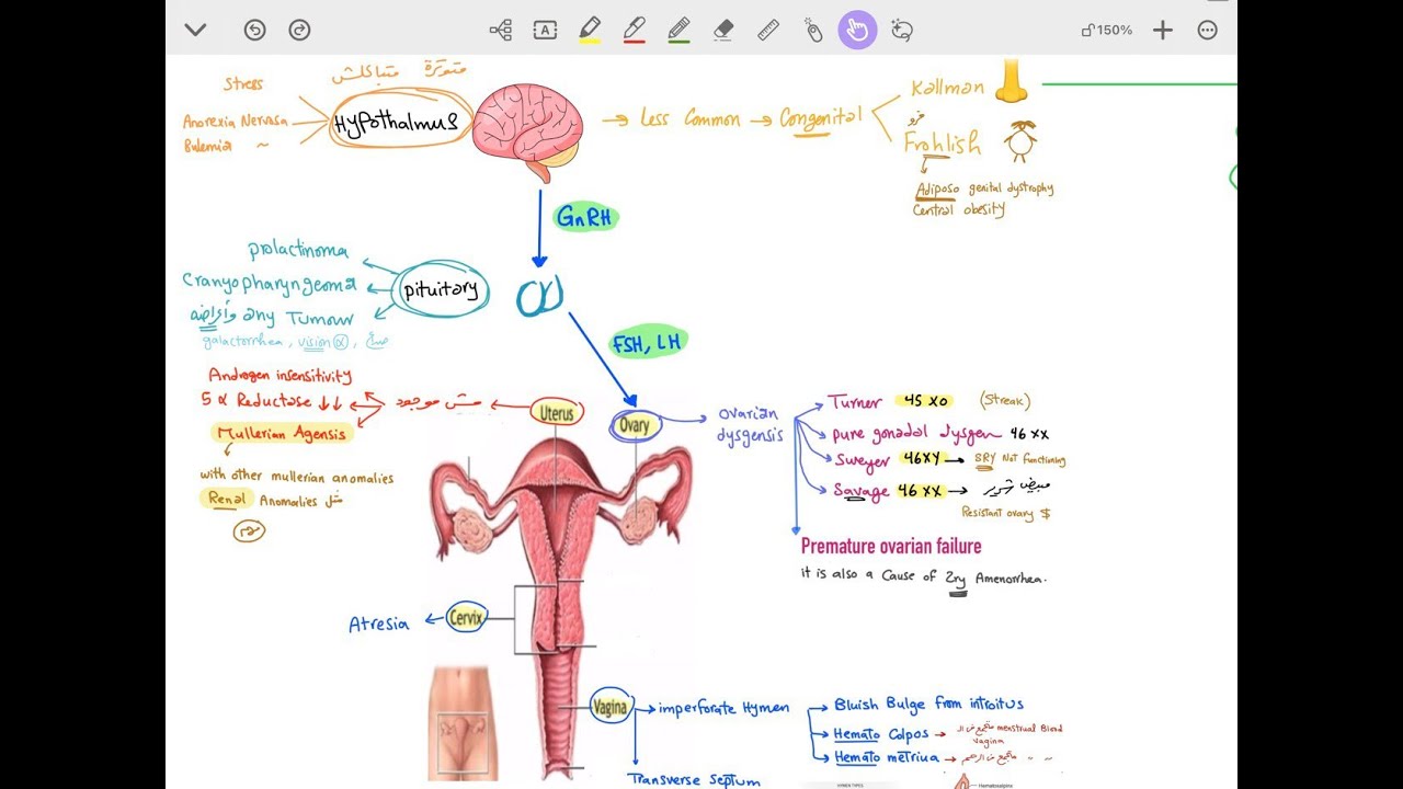 Polycystic Ovary Syndrome & Amenorrhea (2 in 1) - YouTube