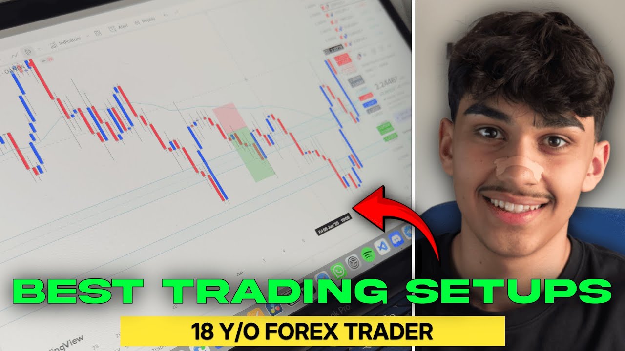 High-Probability Forex Trade Setups You Can’t Miss Next Week | Set And ...