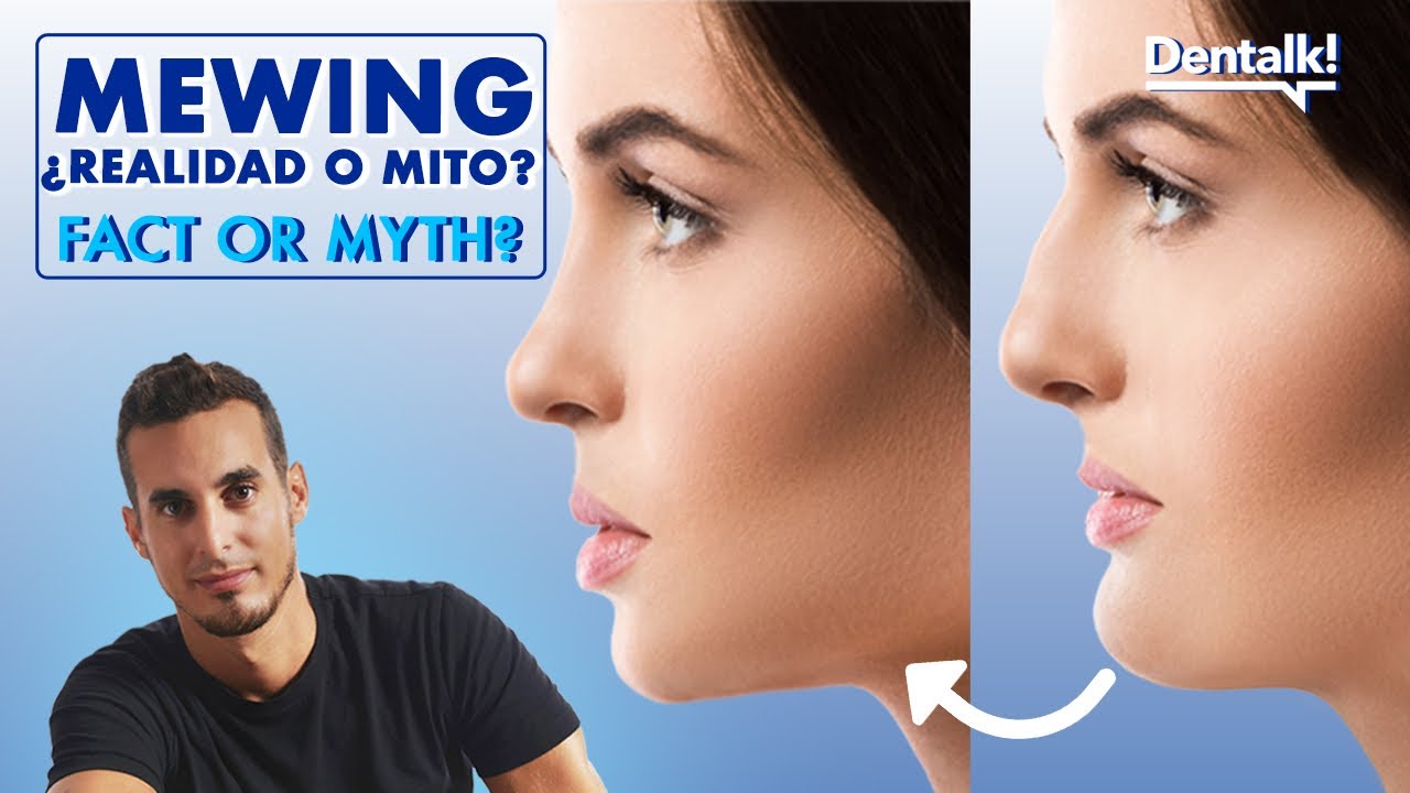MEWING - ¿Funciona realmente? - Toda la VERDAD explicada - Dentalk ...