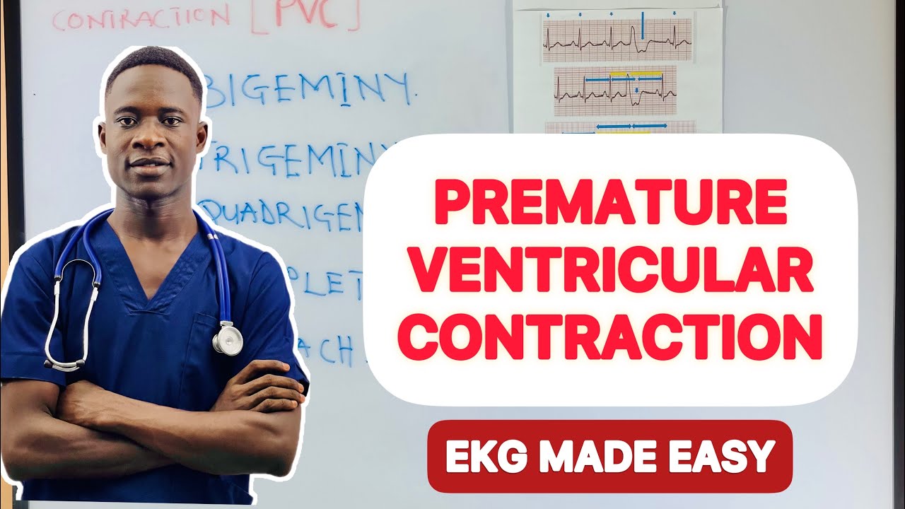 How to read EKG P12 | Premature Ventricular Contraction ( PVC )| - YouTube