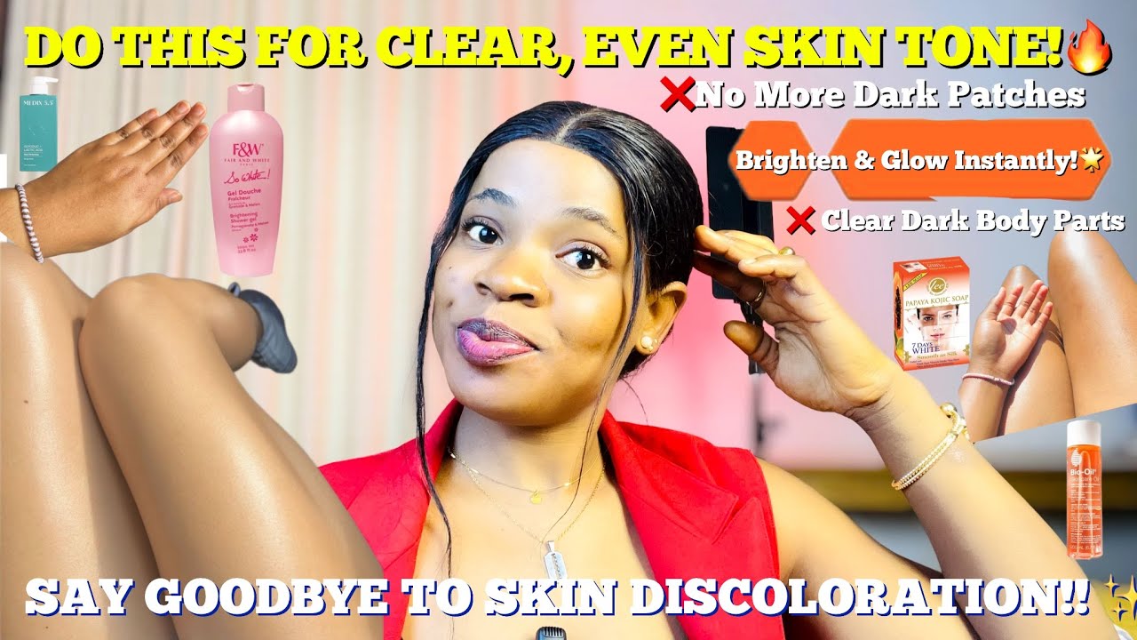 HOW TO GET RID OF SKIN | BODY DISCOLORATION + Do this for Even-Toned ...