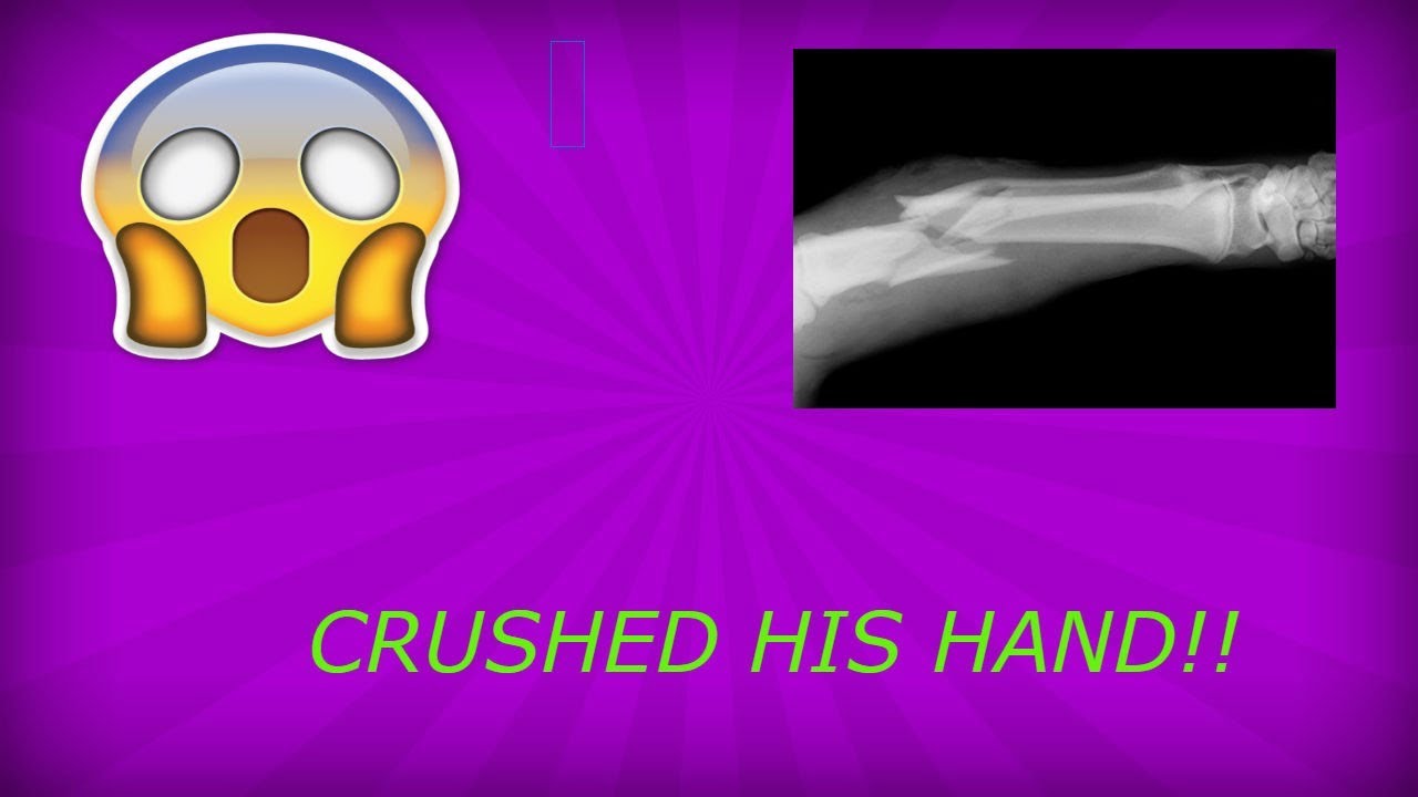 KID BREAKS HAND *ACTUAL FOOTAGE* - YouTube
