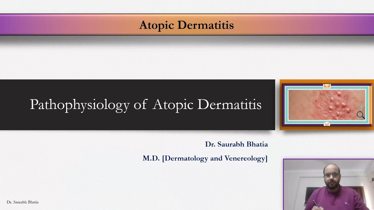 Pathophysiology of Atopic Dermatitis: Genetics; Barrier Damage; Immune ...