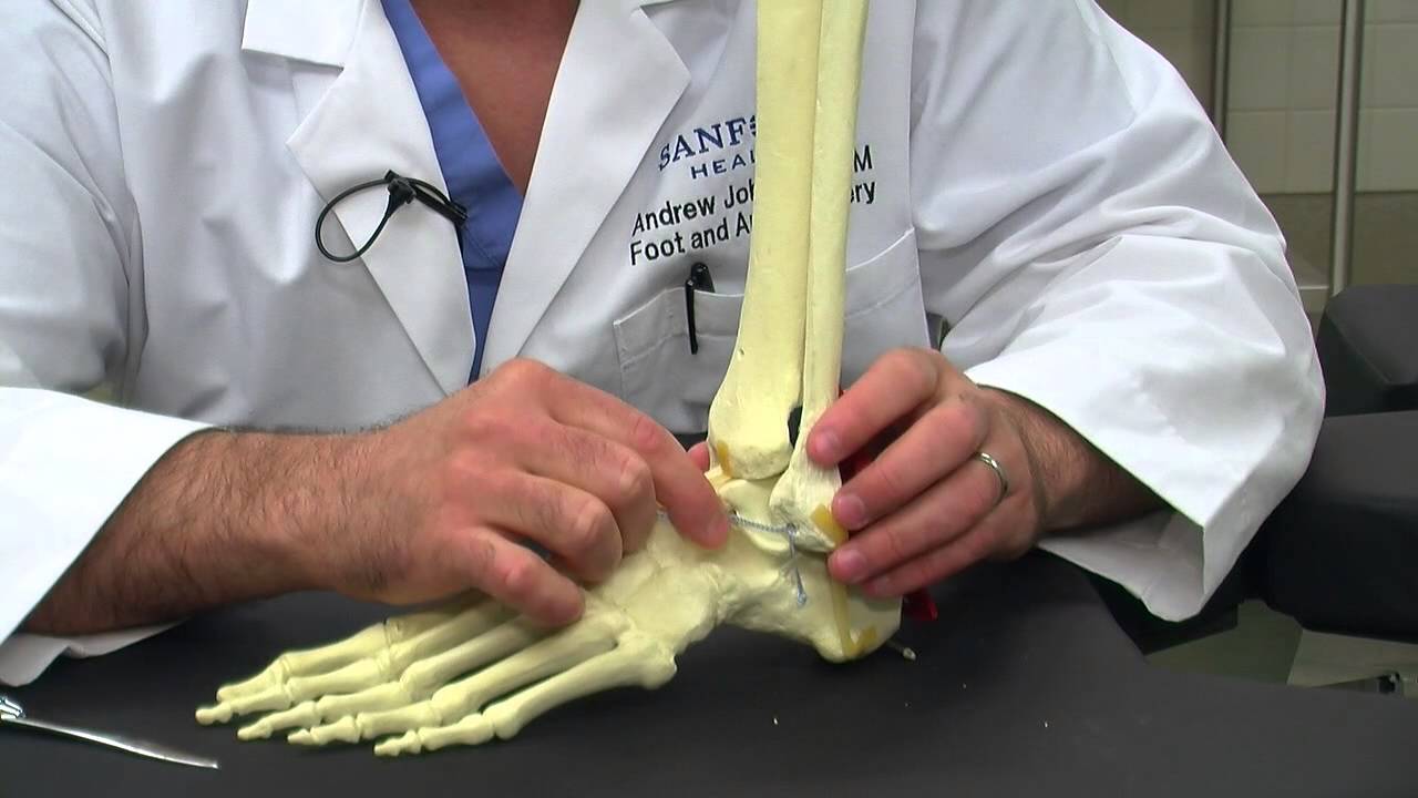Ankle Surgery Demonstration - YouTube