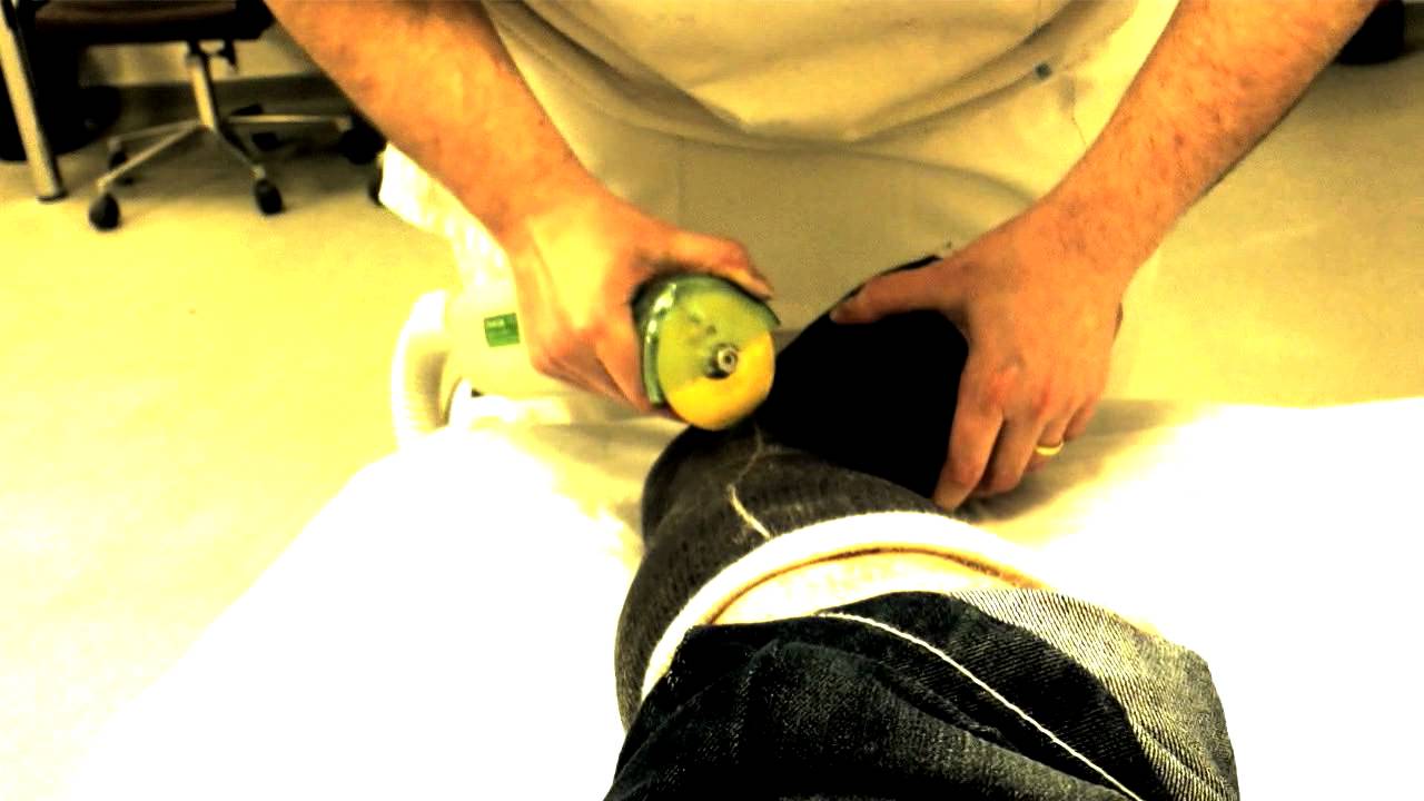 Leg Cast Coming Off - YouTube