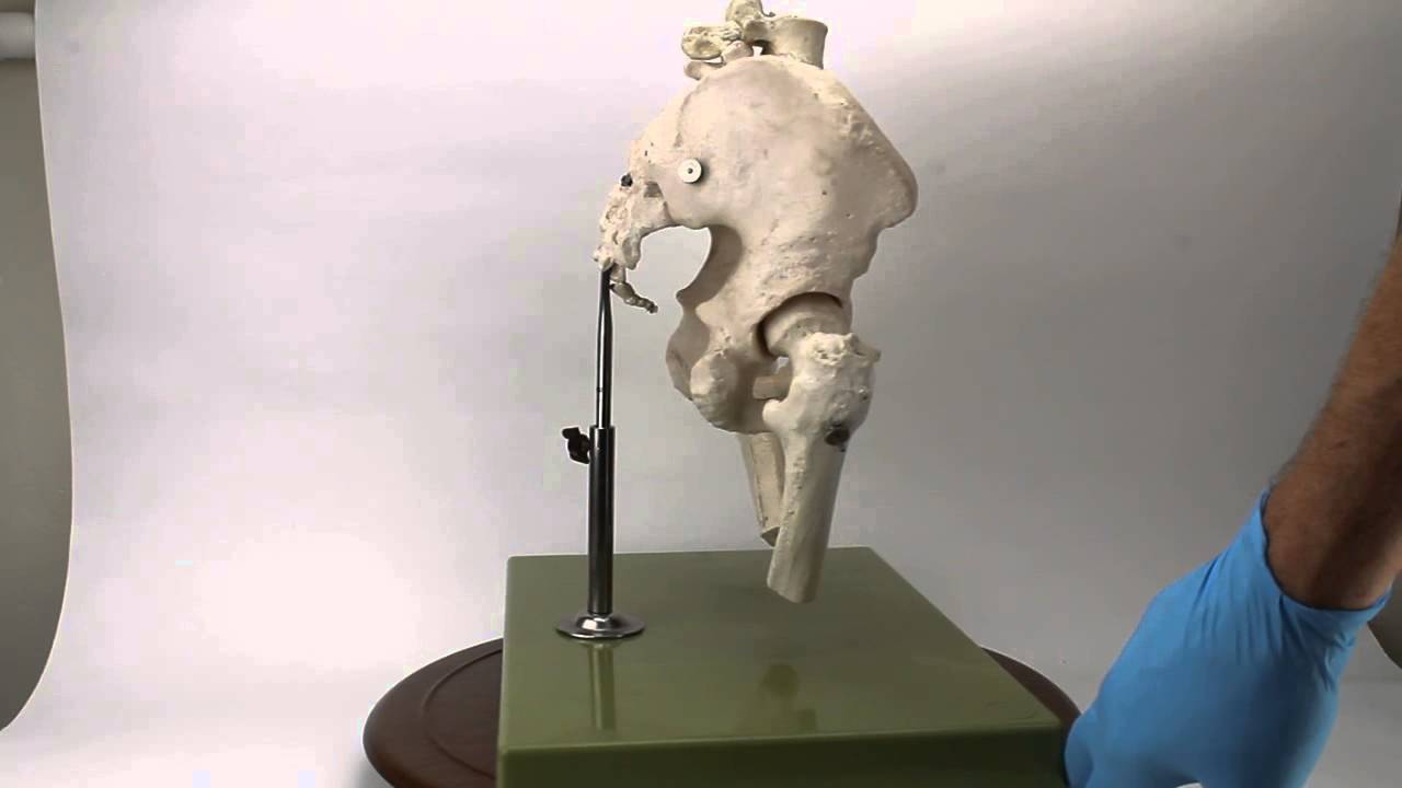 Somso Pelvis Model Product Demo - YouTube