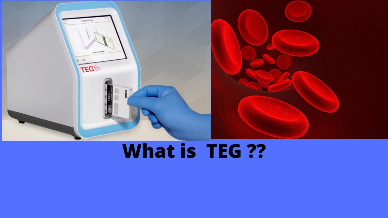 What is TEG - YouTube