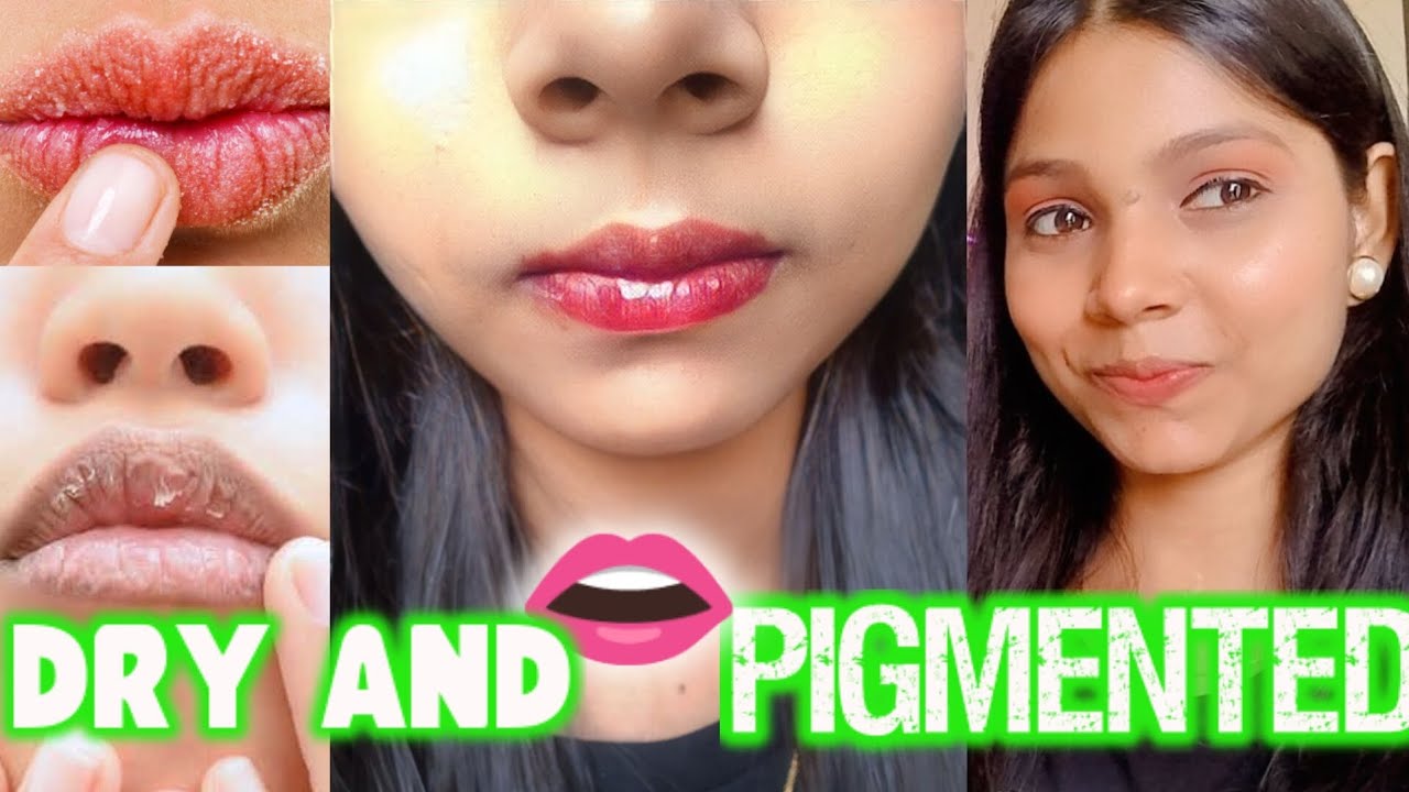How i get rid of Pigmented Lips 👄 REAL LIP CARE ROUTINE lips blackness ...
