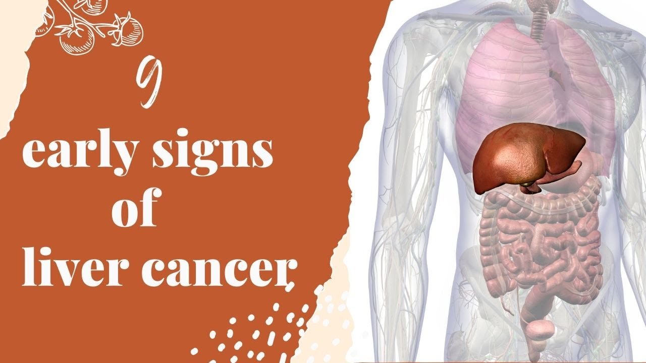 9 early signs of liver cancer | what are some symptoms of liver cancer ...