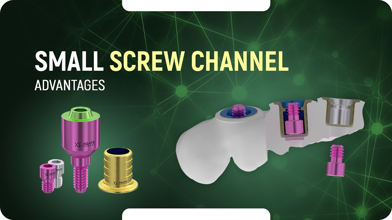 Advantages of Small holes Multi Unit 🦷 XGATE DENTAL - YouTube