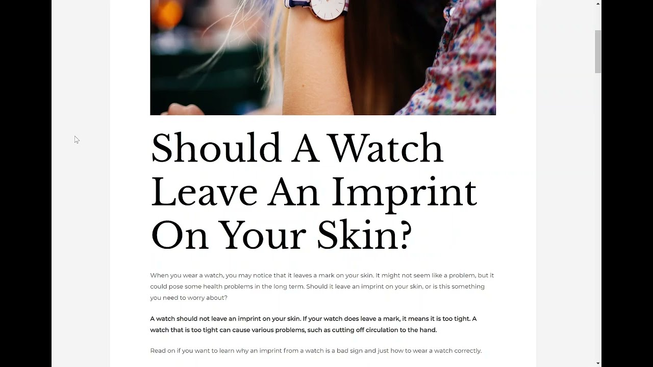 Should A Watch Leave An Imprint On Your Skin?! - YouTube