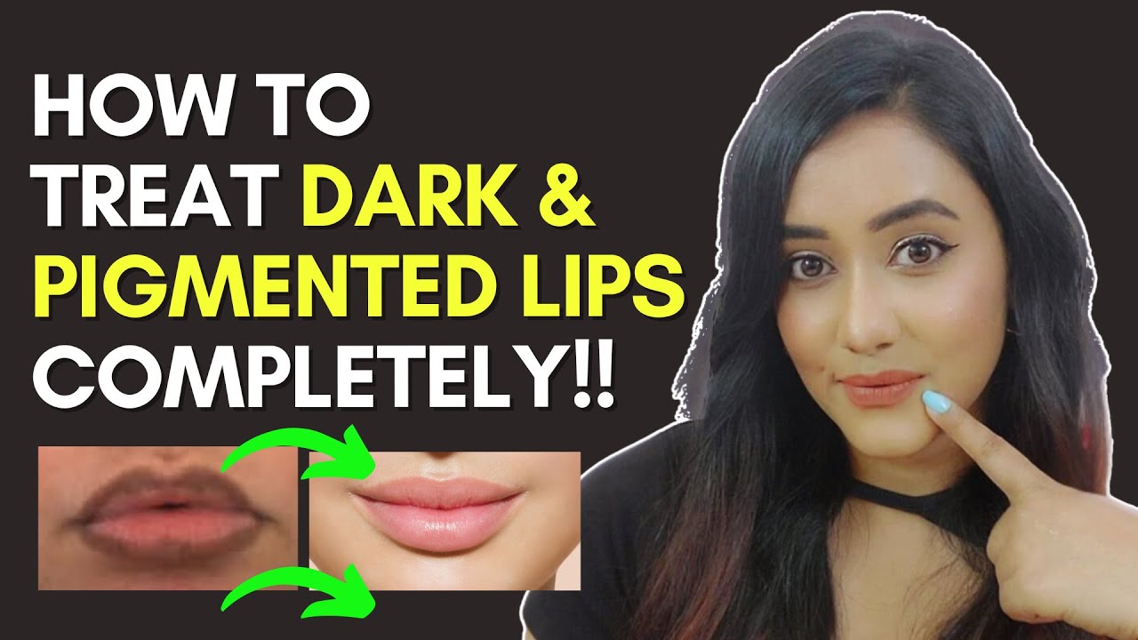 Dark Lips & Lips Pigmentation - Complete Treatment. Treat your Dark ...