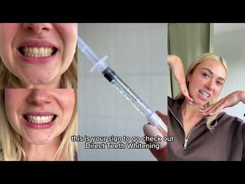 Pola Teeth Whitening Gels - Most Asked Questions and Answers