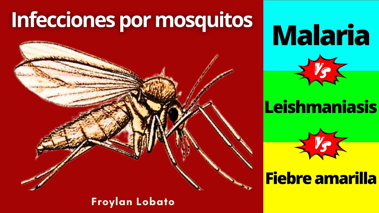 Paludismo (Malaria), Leishmaniasis, Fiebre amarilla 🦟| Diagnóstico diferencial y tratamiento ...