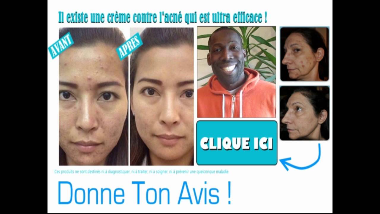 locacid avis - YouTube