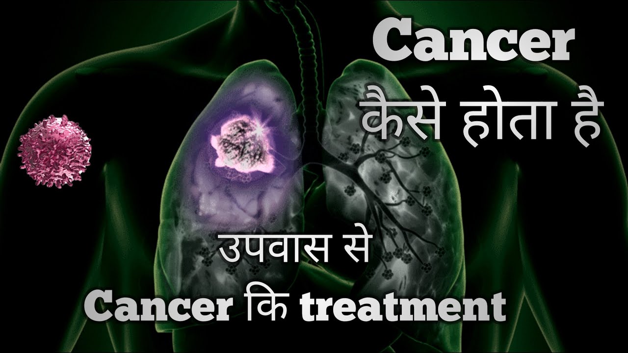 Cancer कैसे होता है| How Cancer Form| Fasting cure cancer| Tumor cells ...