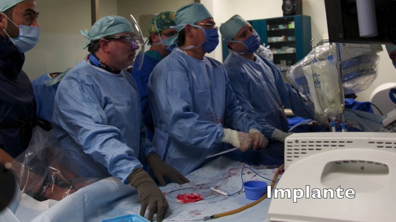 TAVI- CoreValve "Implante Valvular Aortico Trancateter" - YouTube