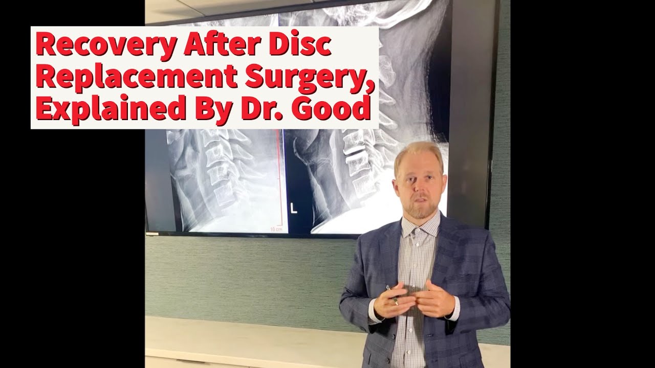 Have Questions About Recovery After Disc Replacement Surgery? Dr. Good ...
