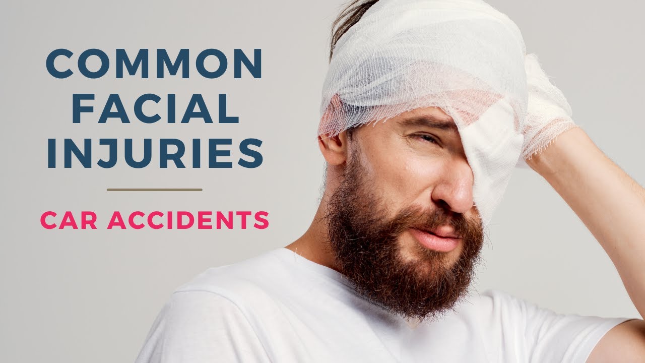 Common Facial Injuries Caused By Car Accidents - YouTube