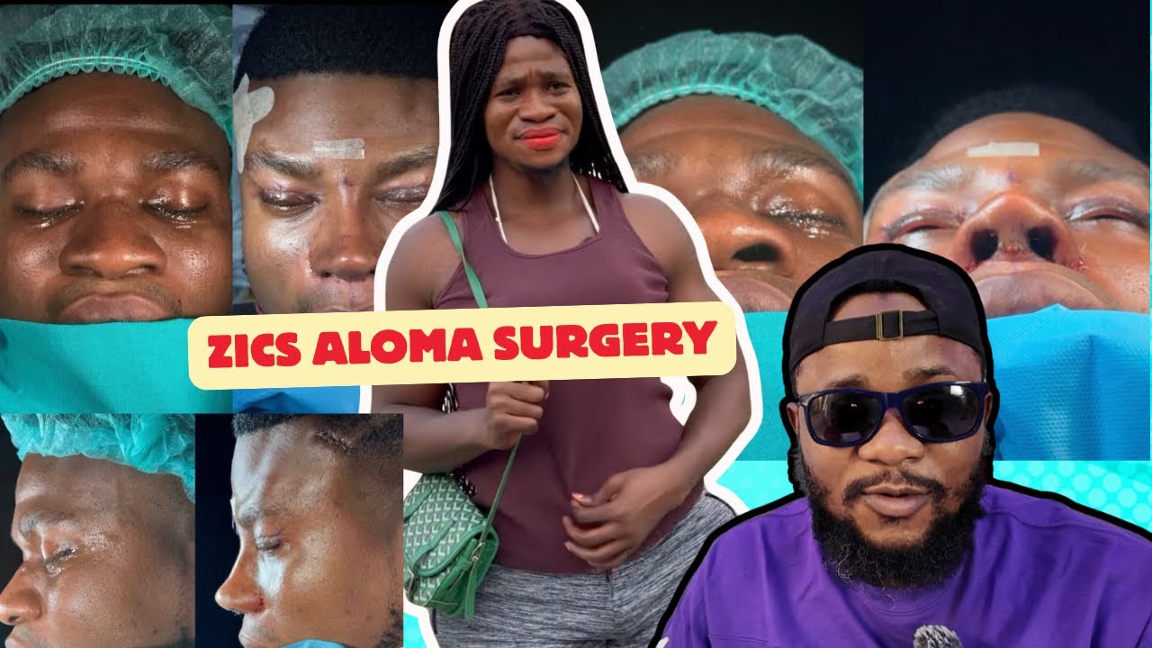 Nigeria Comedian Zics Aloma Nose Surgery / Yul Edochie Wife Judy - YouTube