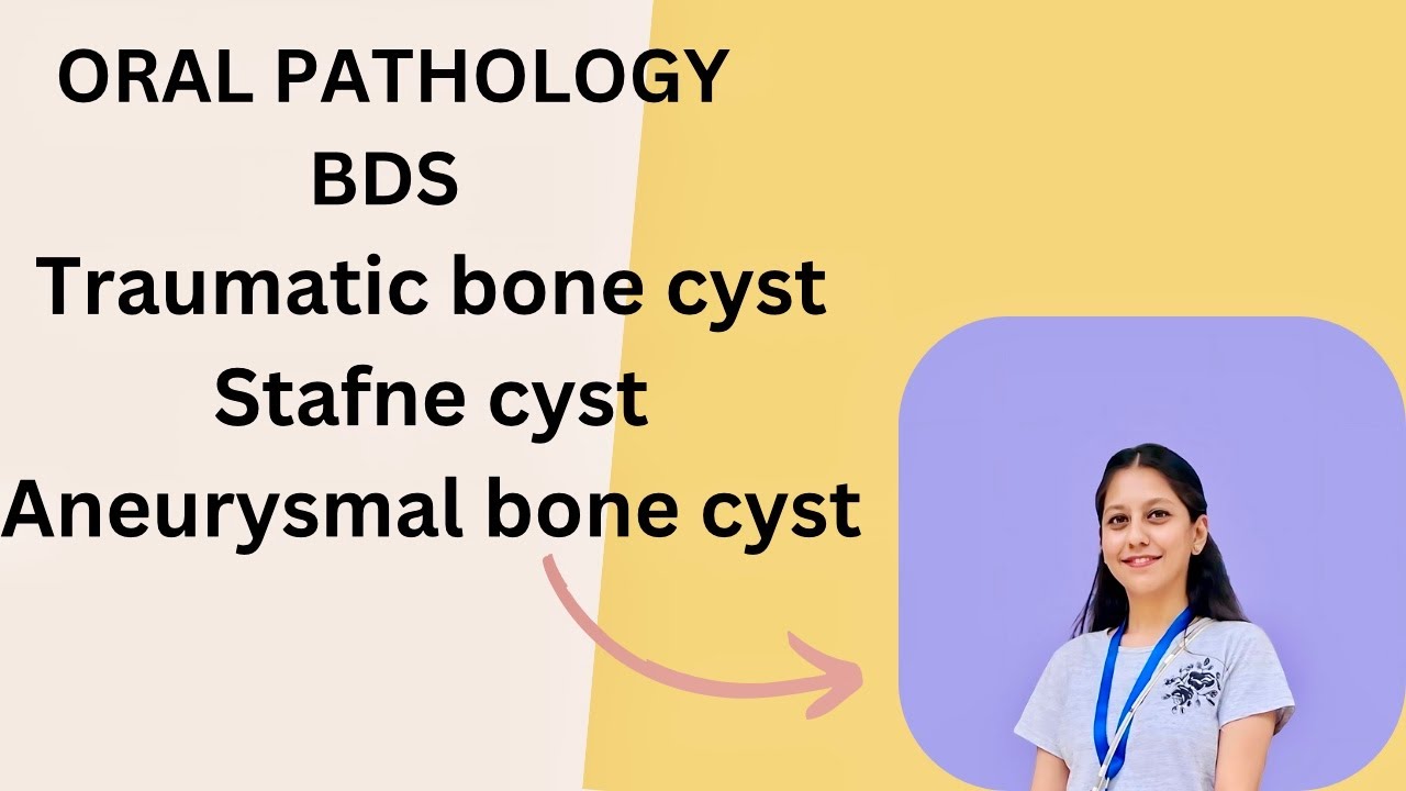 Oral Pathology | BDS | Traumatic bone cyst | Stafne cyst | Aneurysmal ...