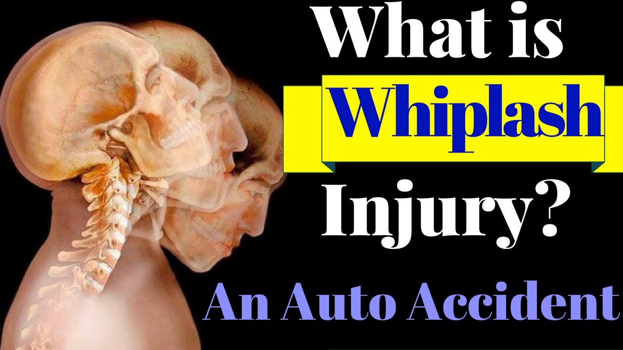 What Is Whiplash Personal Injury Lawyer YouTube what-is-whiplash-personal-injury-lawyer-youtube
