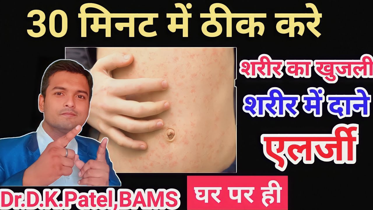 शरीर में दाने और खुजली होने का कारण🤭sharir mein dane aur khujli🤭sarir ...