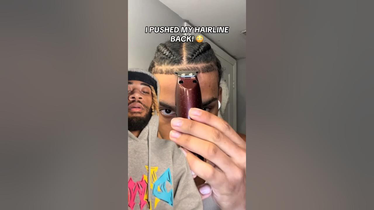 Insane Hairline Pushback Shorts Youtube