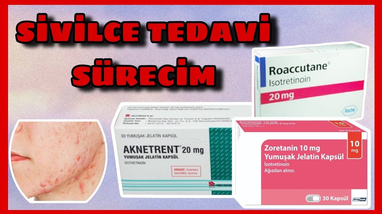 SİVİLCE TEDAVİ SÜRECİM ( Roaccutane / Zoretanin / Aknetrent ) - YouTube