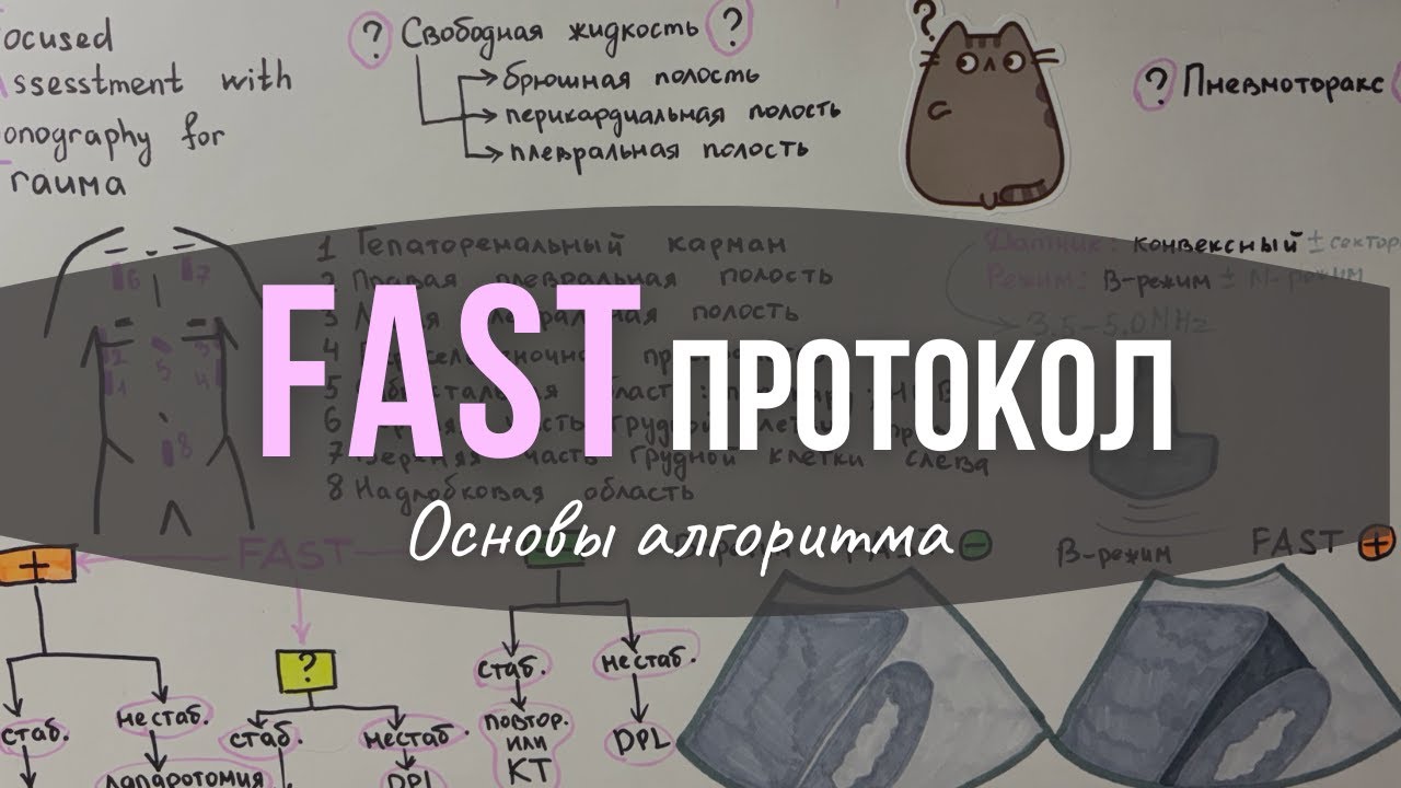 УЗИ: FAST протокол - YouTube